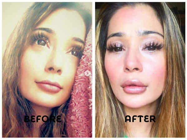 Lip Surgery Gone Wrong Sara Khan Gets Trolled on social media - Hindi ...